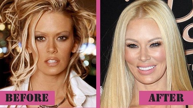 Before and After pictures are always better, someone find me some worse ... Before and After pictures are always better, someone find me some worse ...