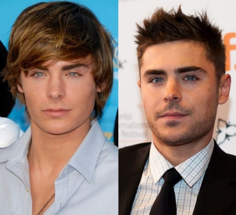 Zac Efron Has He Used Plastic Surgeries
