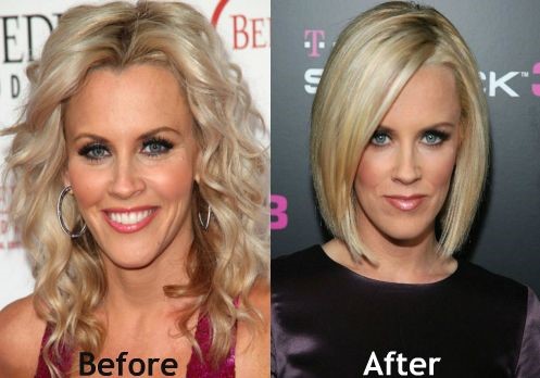 Jenny McCarthy before and after plastic surgery 07 | Celebrity plastic ...