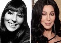 Cher multiple plastic surgery procedures for youthful look?