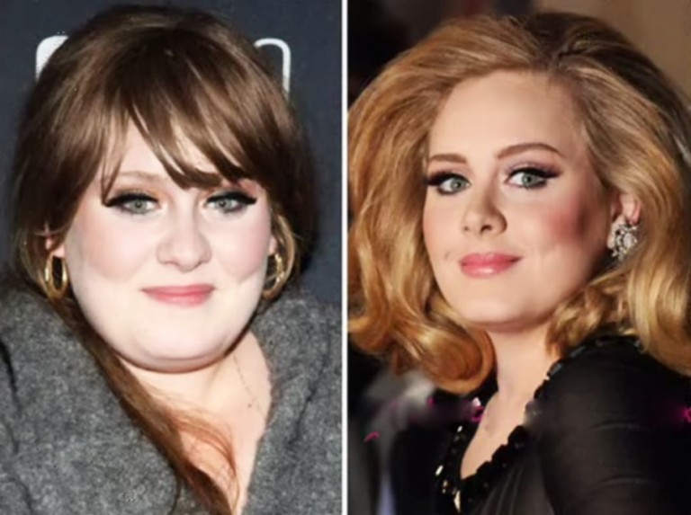 Adele looks great after plastic Surgery