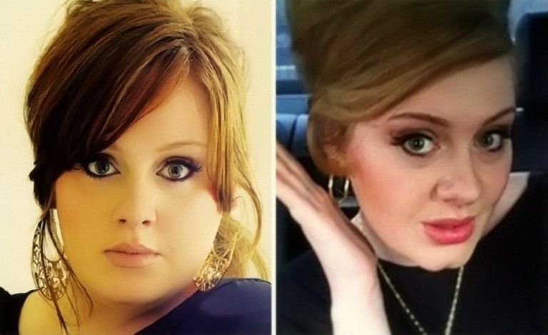 Adele looks great after plastic Surgery