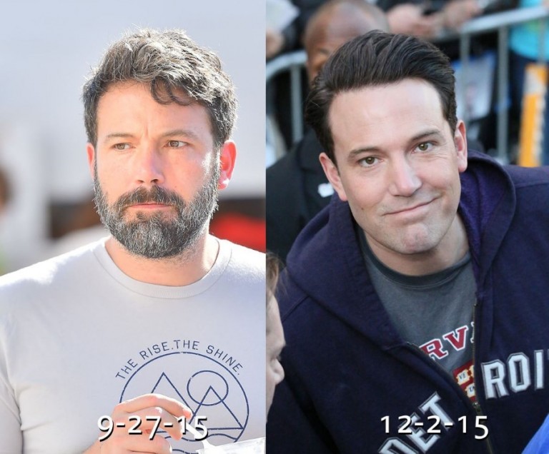 Ben Affleck improving his look with plastic surgery?