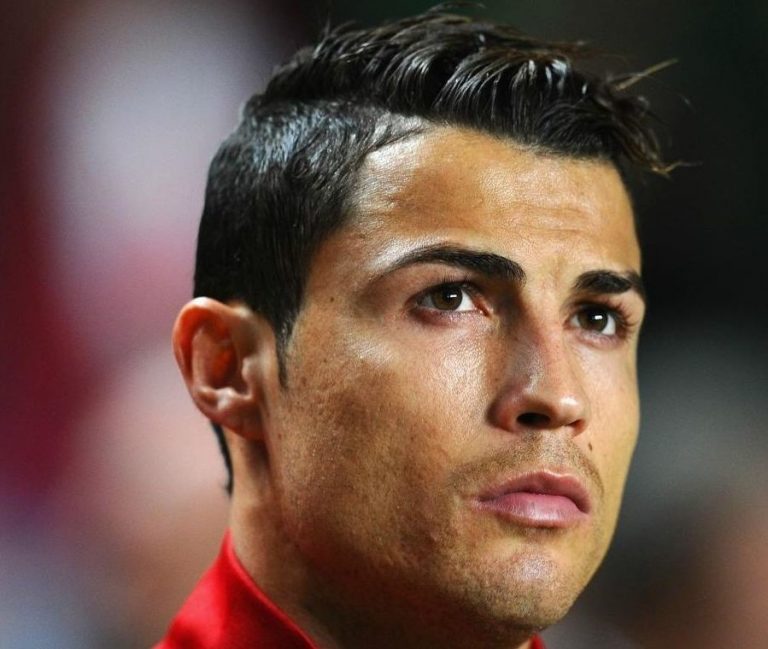 Cristiano Ronaldo - Reality About his Plastic Surgery!