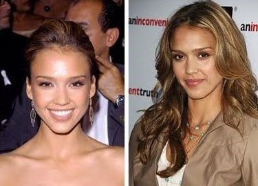 Jessica Alba: Plastic Surgery or Is She Blessed by Nature?