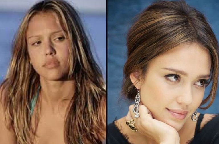 Jessica Alba: Plastic Surgery or Is She Blessed by Nature?