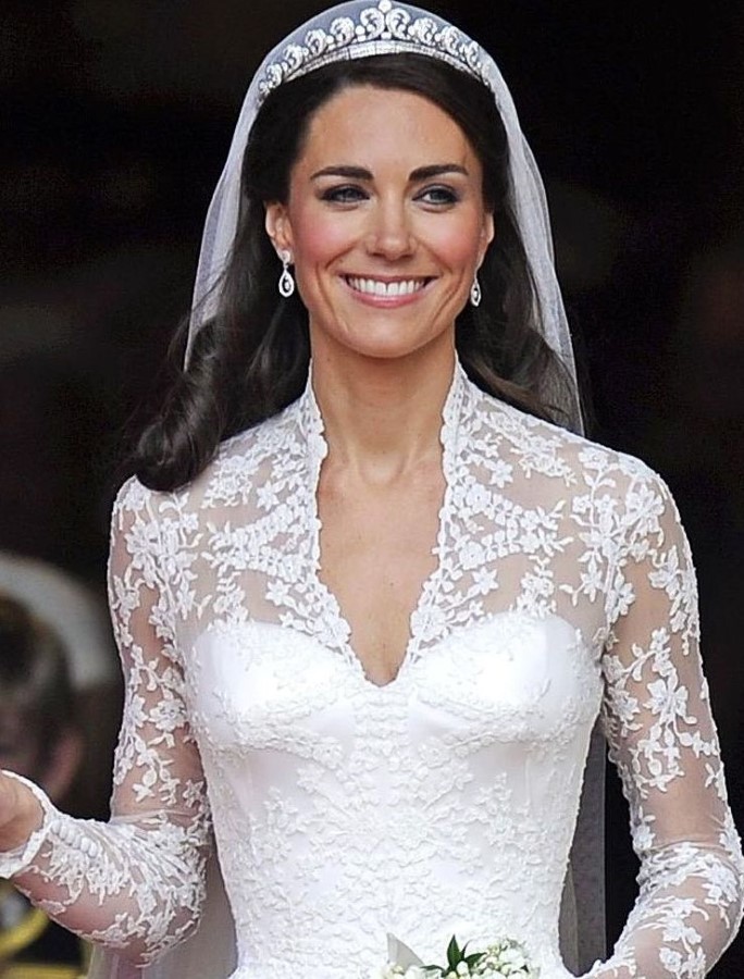 Kate Middleton The Duchess of Cambridge and Plastic Surgery?
