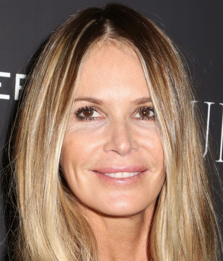 Elle Macpherson Supermodels also use plastic surgery!