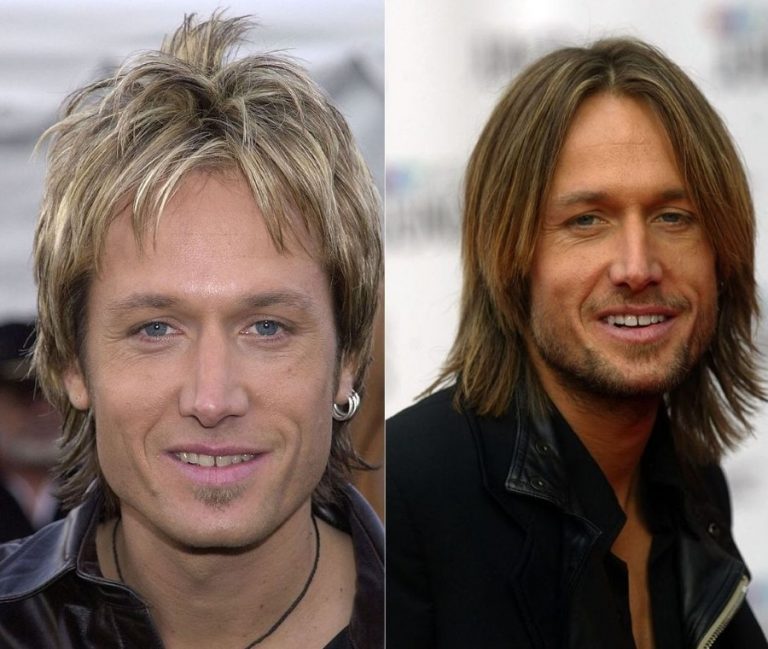 Keith Urban After cocaine plastic surgery addiction