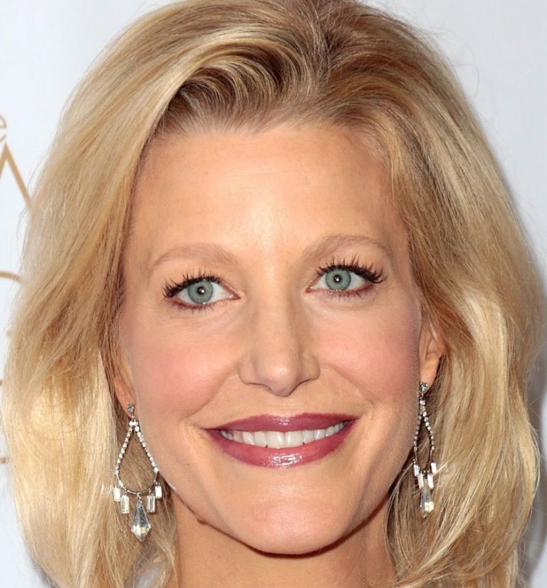 Anna Gunn Breaking Bad and plastic surgery