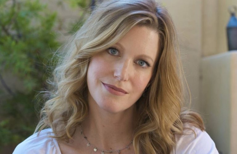 Anna Gunn Breaking Bad and plastic surgery