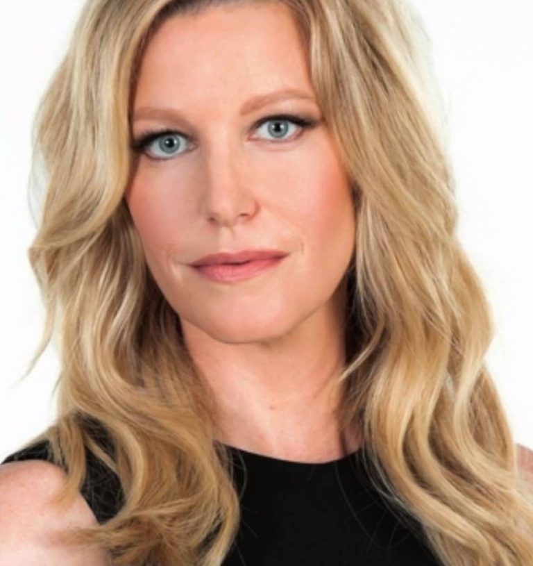 Anna Gunn Breaking Bad and plastic surgery