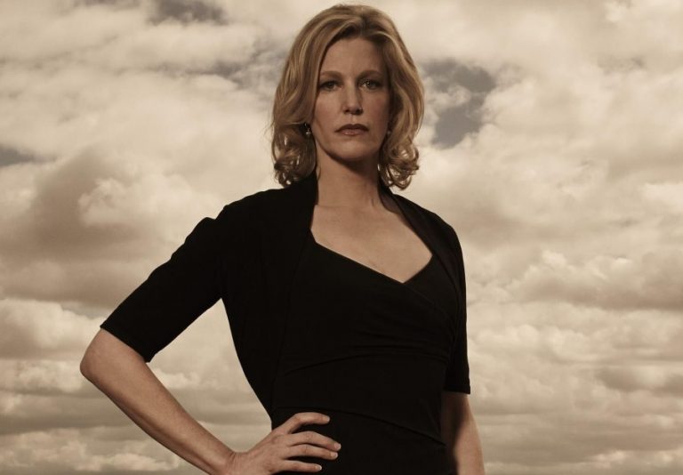 Anna Gunn Breaking Bad and plastic surgery