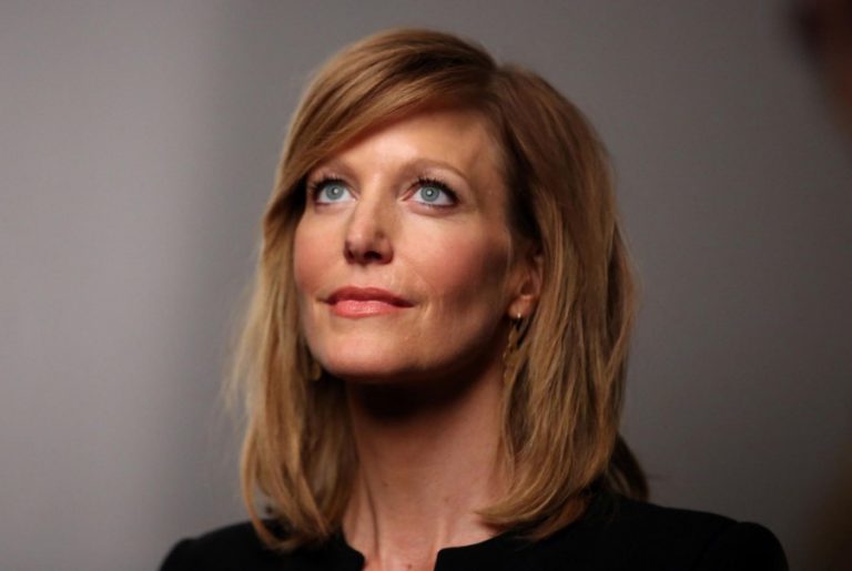Anna Gunn Breaking Bad and plastic surgery