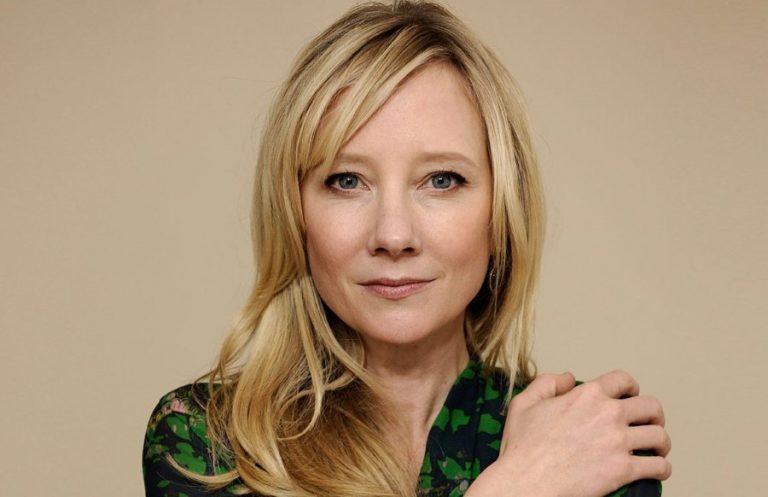 Anne Heche and plastic surgery