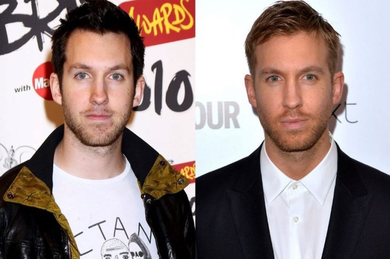 Calvin Harris and Plastic Surgery Transformation