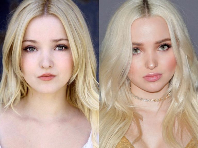 Dove Cameron’s Transformations using plastic surgery